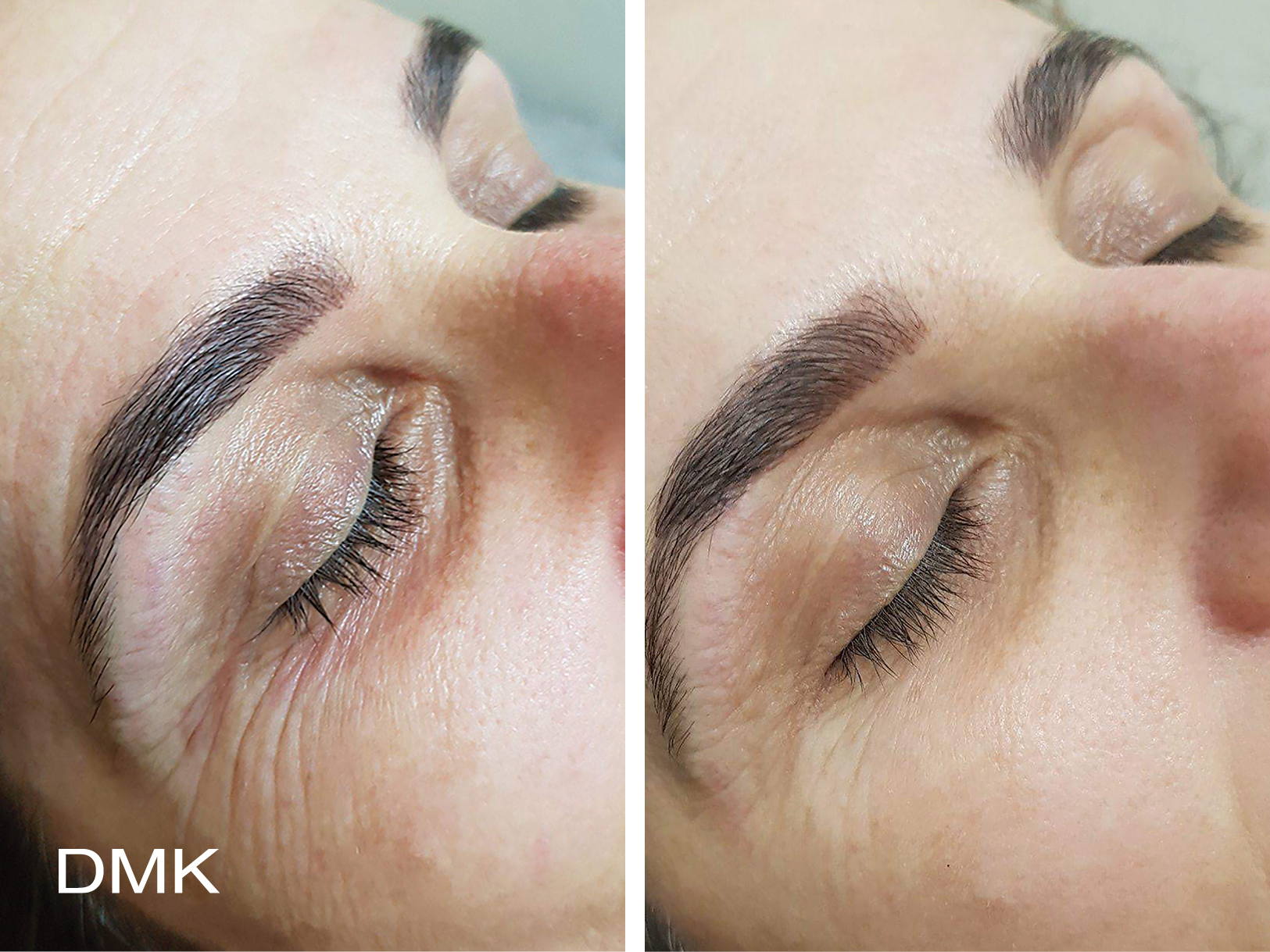 Ageing - DMK Results - DMKCustomer